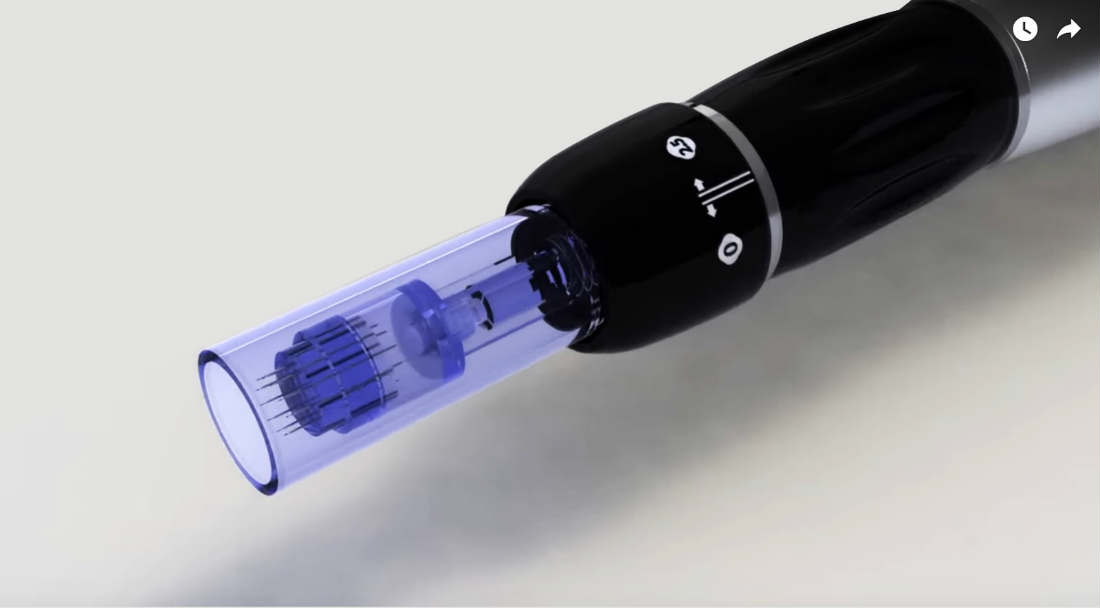 Improve Your Acne Scars with Dermapen Microneedling