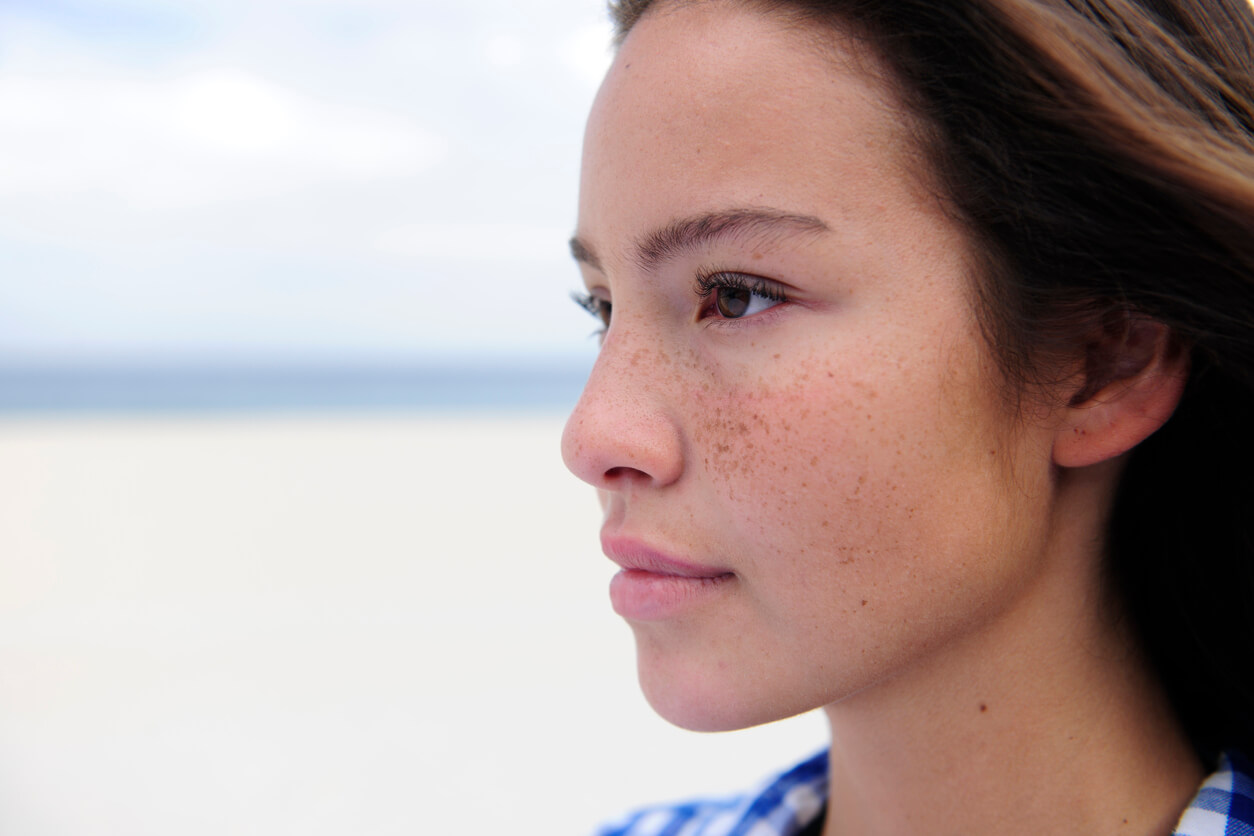 Why Do I Have Freckles? | Cutis Laser Clinics