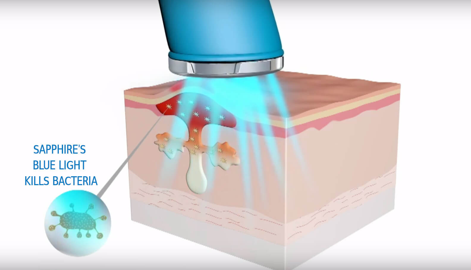 Rejuvenate Your Skin with Safe LED Skin Therapy Facials