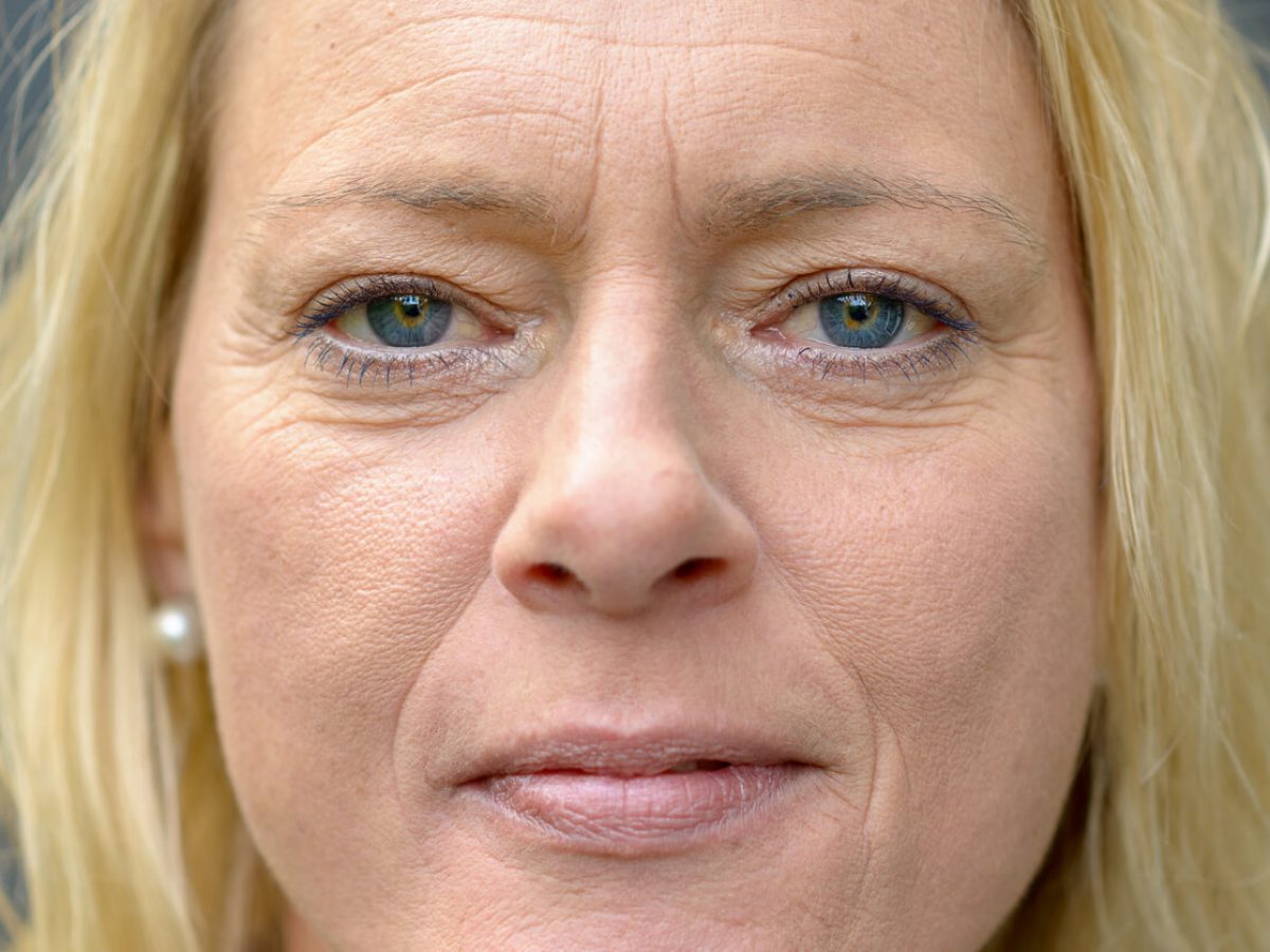 Wrinkled Forehead Angry