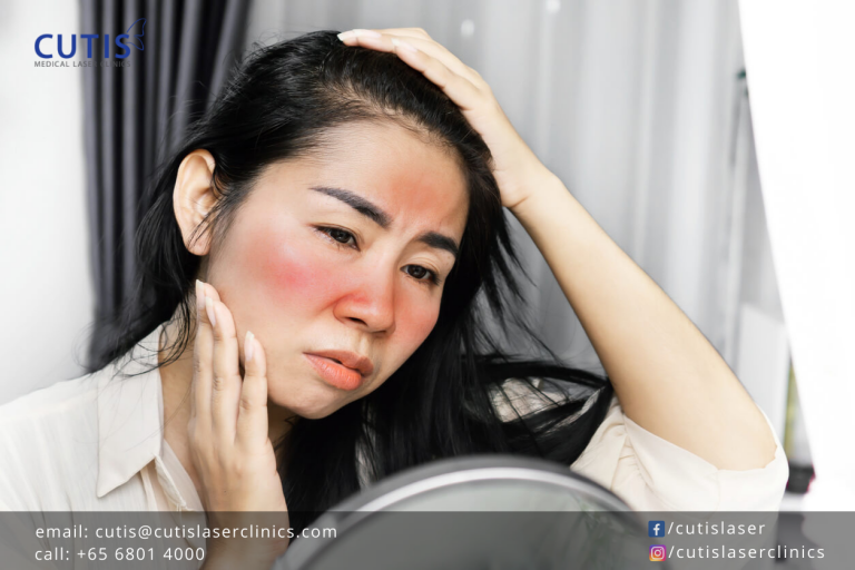 Is Your Facial Skin Prone to Redness?