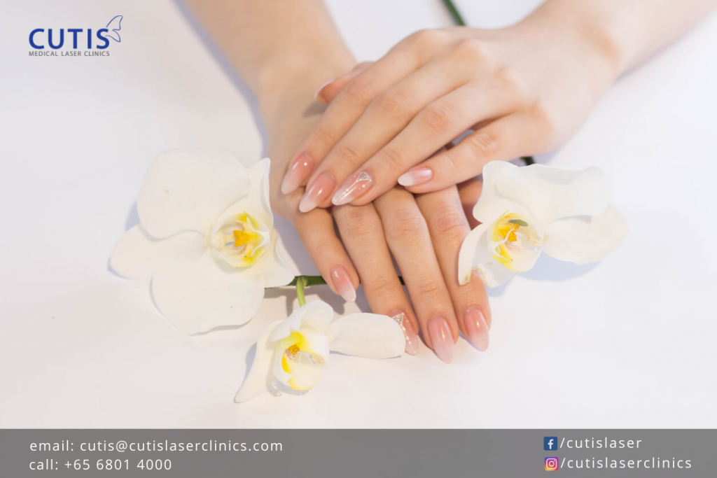 Hand Lift and Rejuvenation with Calcium Fillers