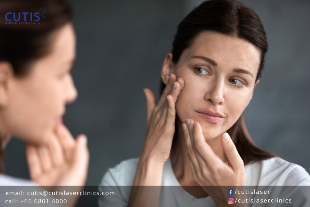What Can You Do About Sudden Breakouts what-can-you-do-about-sudden-breakouts