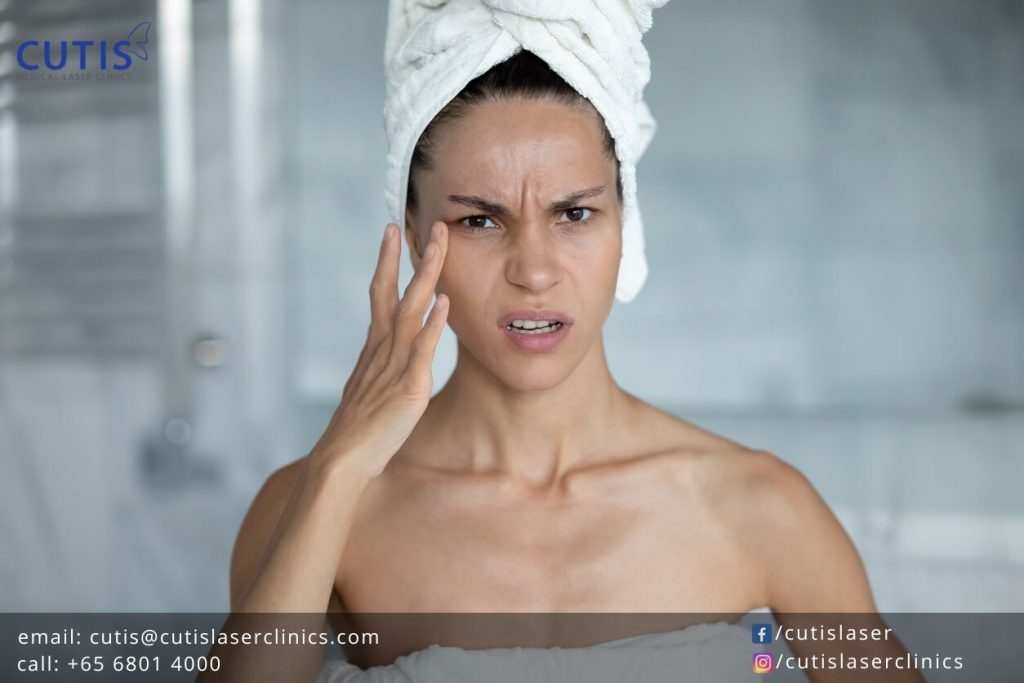 Don’t Let These Makeup Mistakes Wreck Your Skin