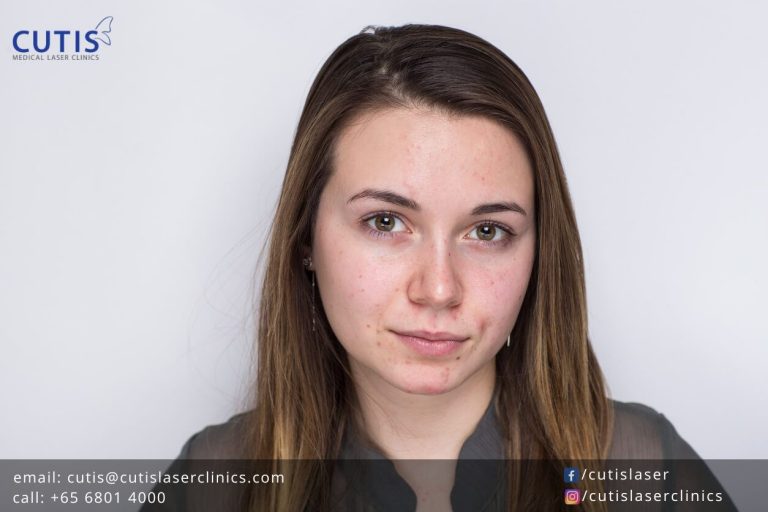 What Happens to Your Skin During Your Menstrual Cycle