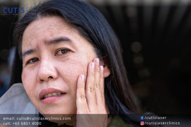 Causes of Rough & Bumpy Skin ? Laser Clinics in Singapore