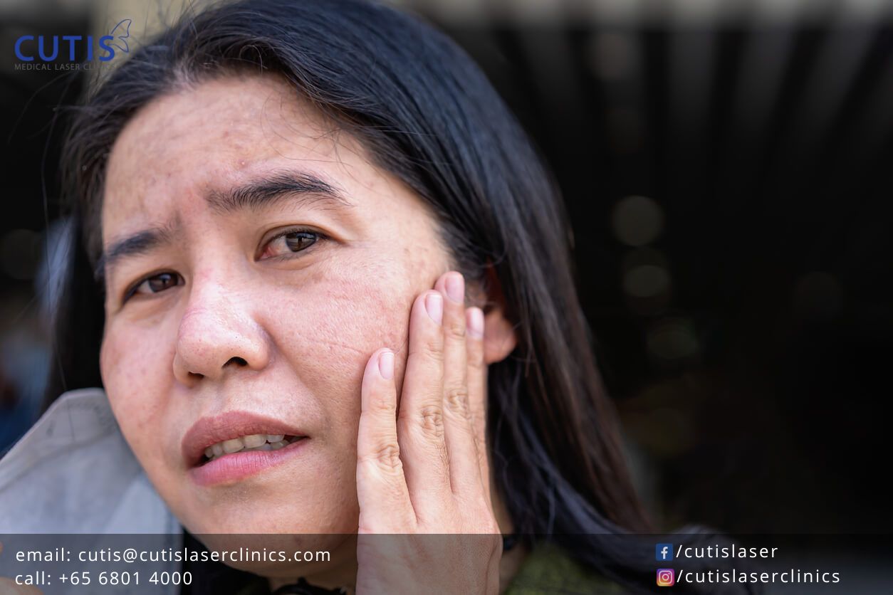 Causes Of Rough Bumpy Skin Laser Clinics In Singapore Causes Of Rough Bumpy Skin Laser Clinics In Singapore